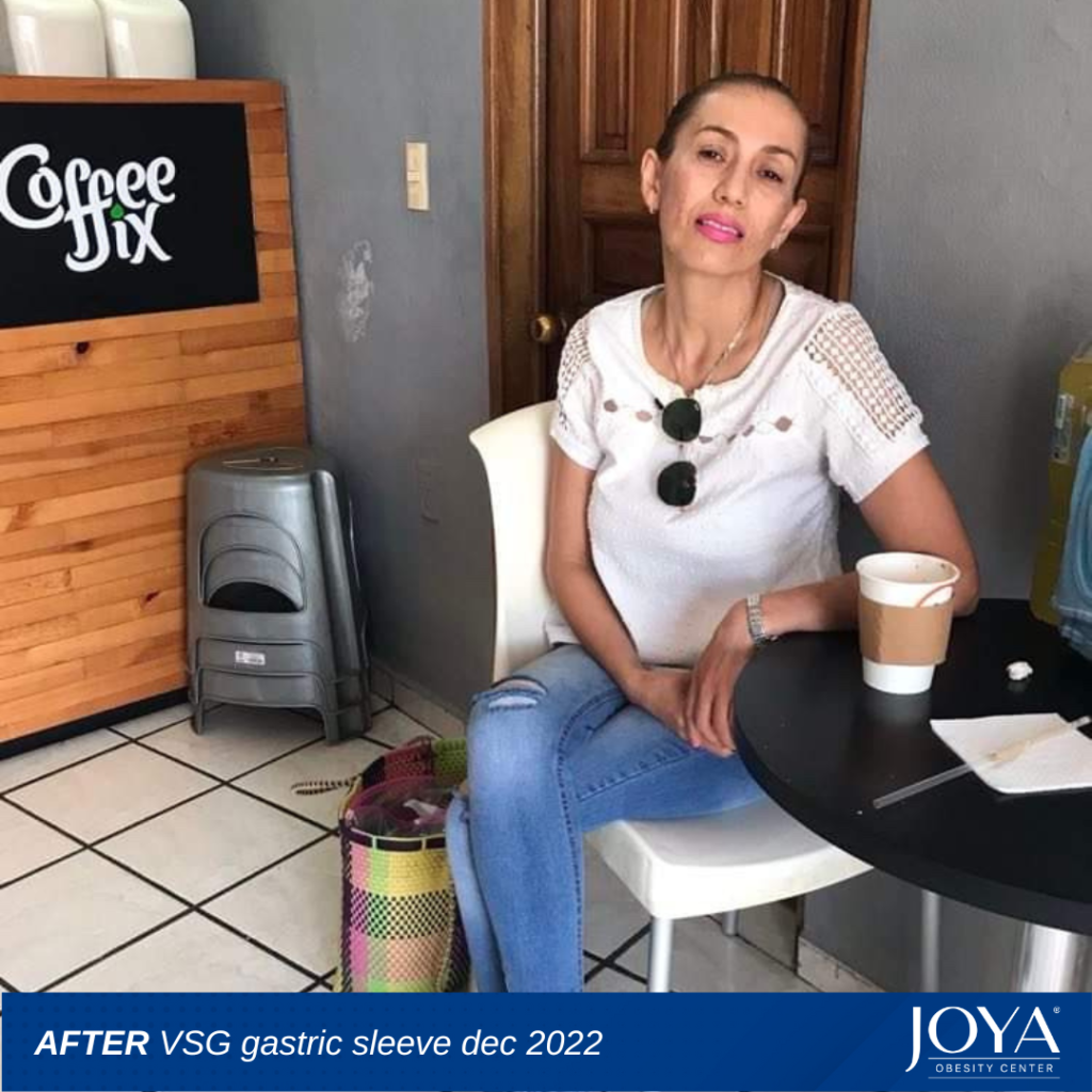 Dr. Joya weight loss surgery Puerto Vallarta testimonials