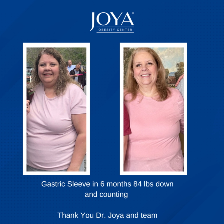 Dr. Joya weight loss surgery Puerto Vallarta testimonials